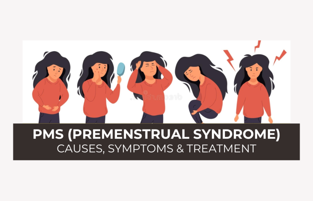 Premenstrual Syndrome (PMS): Causes, Symptoms, and Treatment - Best ...